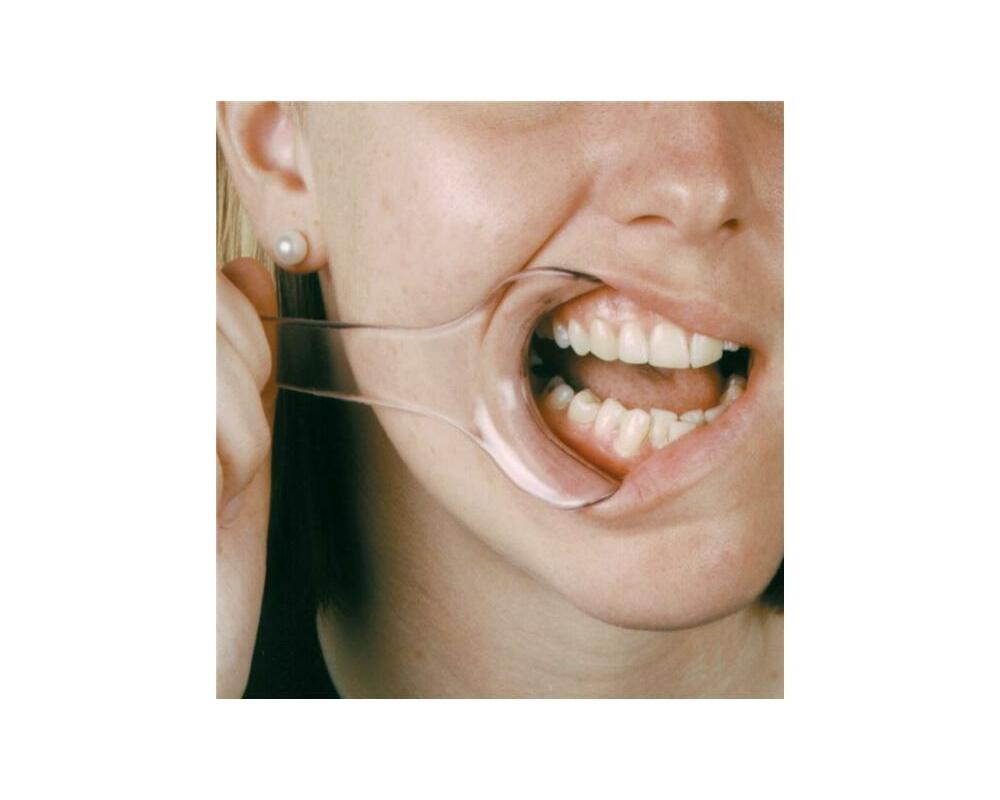 Mirahold Lip & Cheek Retractor Child Clear 2/Pk | 605451 | Supply Clinic