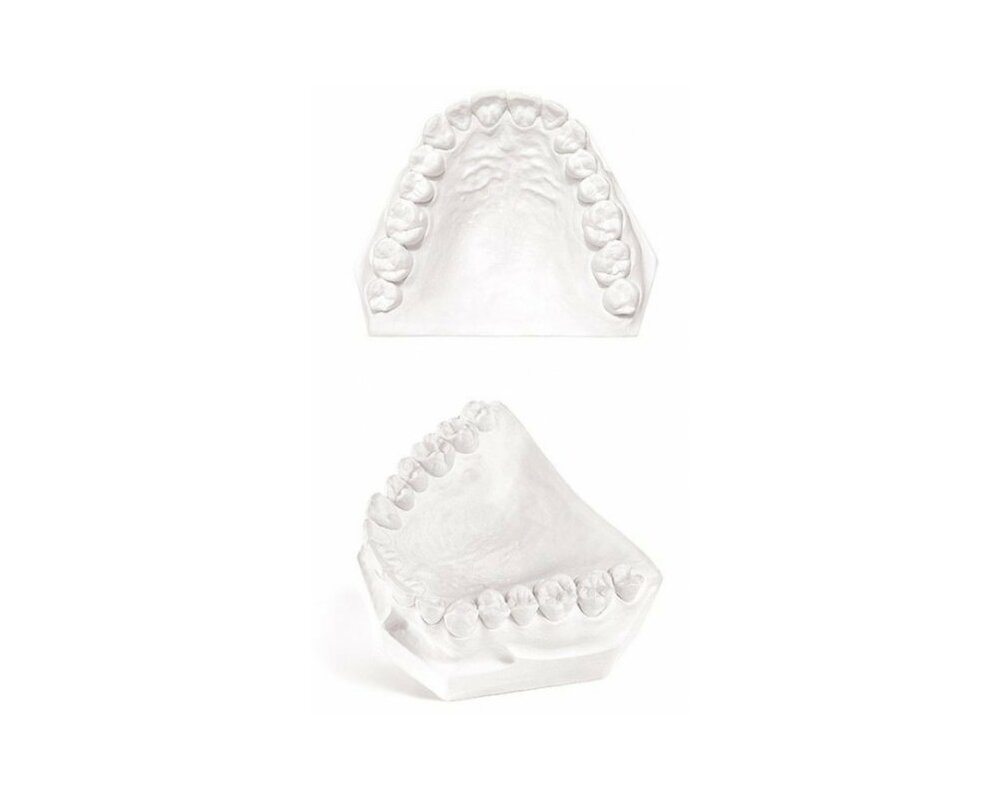 Lab Plaster Regular 50lb | 1450050 | Supply Clinic