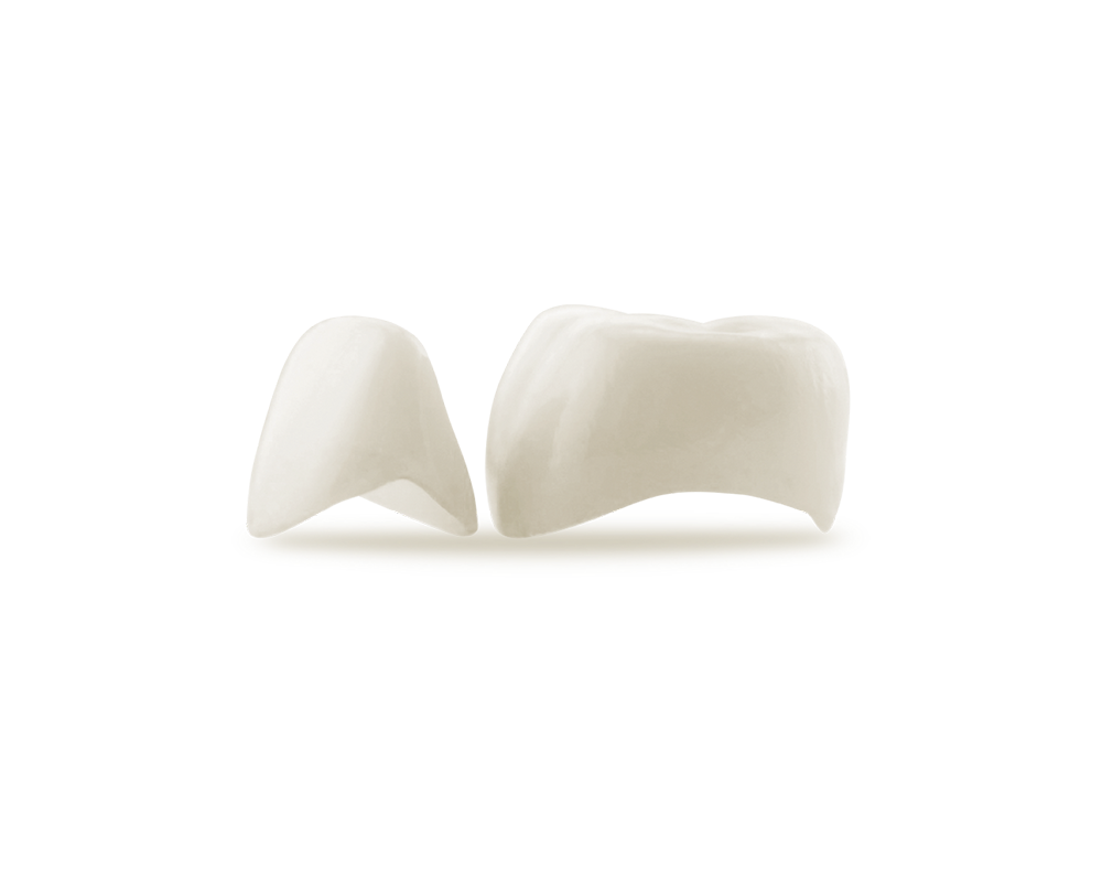 EZ Crown Posterior Space Loss T4 Each | R-EZC-P-T4SL | Supply Clinic