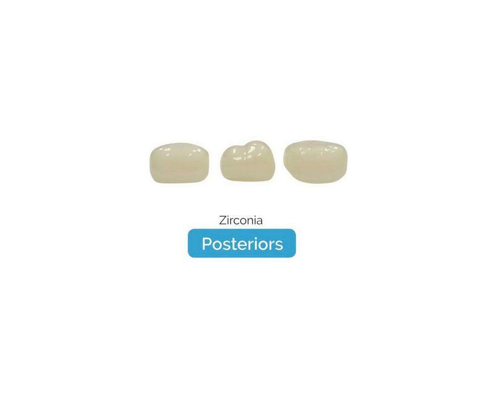 Zirconia Universal Kinder Krowns, Lower, Posterior DL4.5 | KZR DL4.5 ...