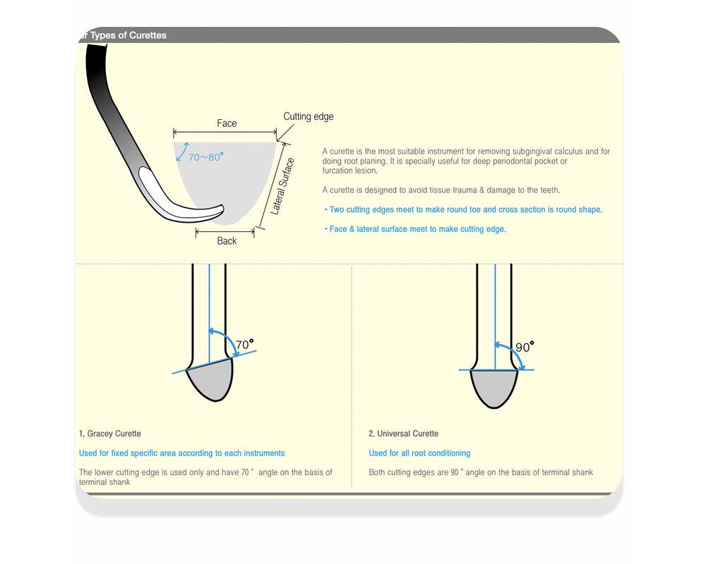 What Is The Difference Between A Universal Curette And A Gracey Curette